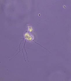 Cercozoa from Hockley County, TX, USA on December 7, 2023 at 03:01 PM ...