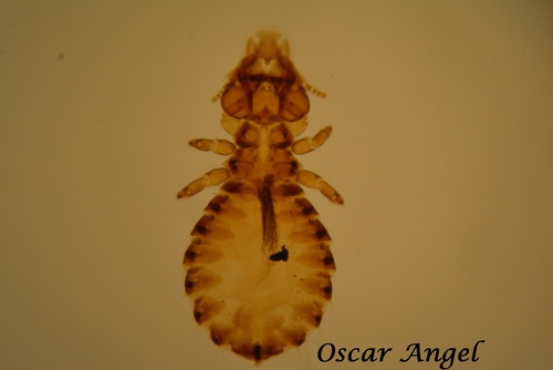 Common duck louse (Anatoecus dentatus)