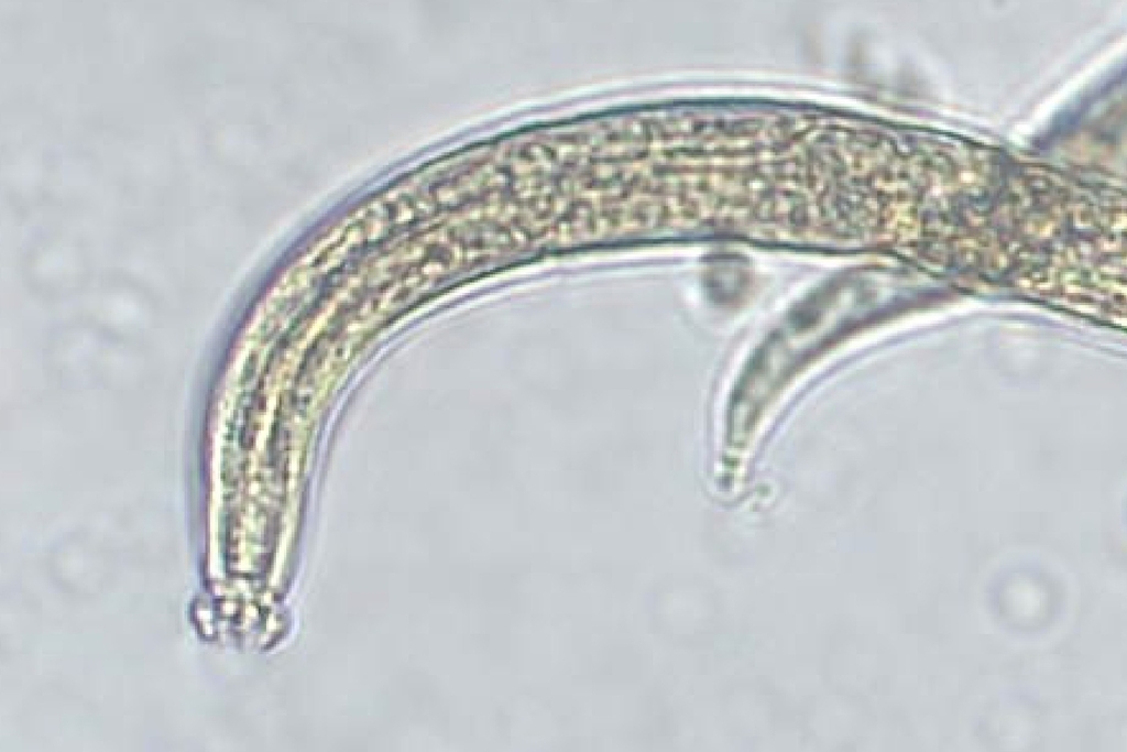 Plectidae from Limbongan, Kec. Gantung, Kabupaten Belitung Timur ...
