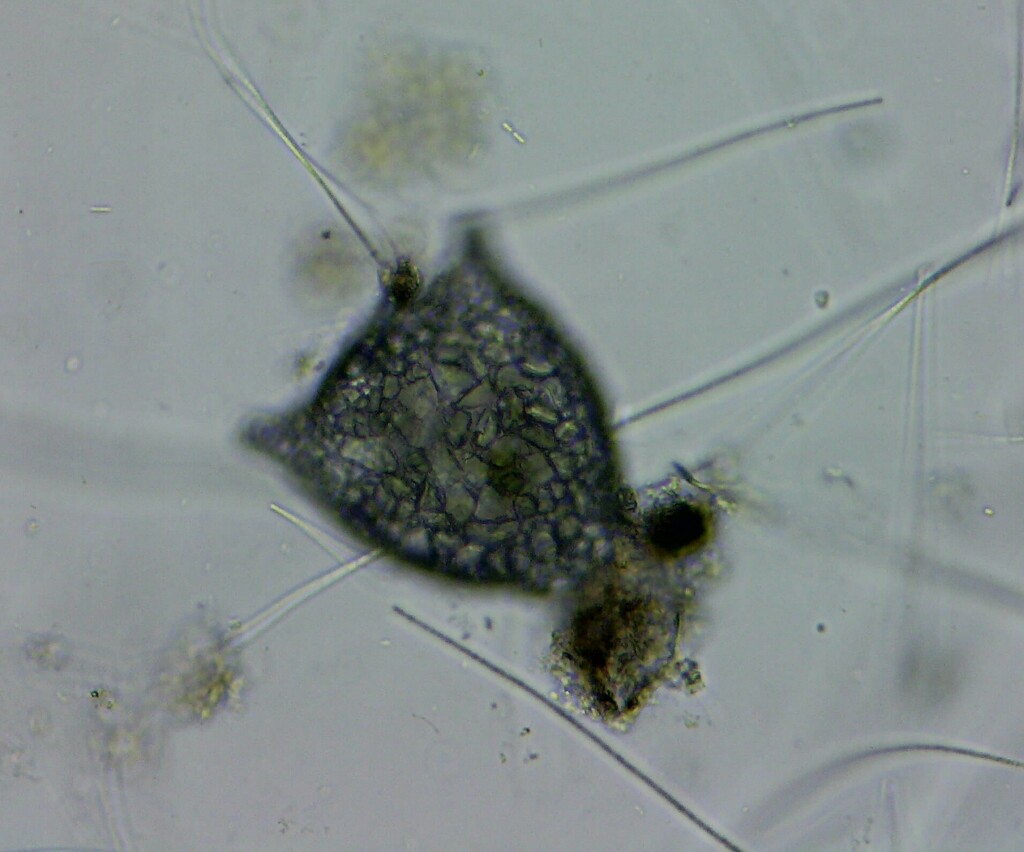 Difflugia from Geelong VIC, Australia on January 10, 2024 at 03:19 PM ...