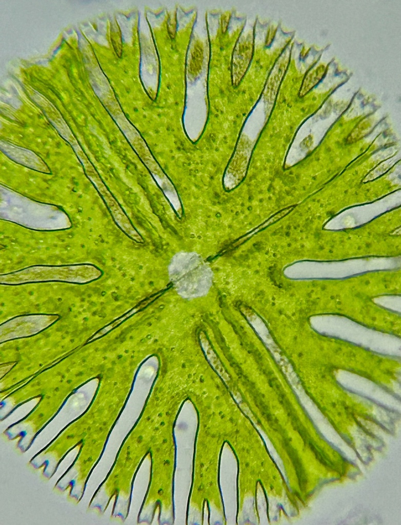 Micrasterias radiosa from Everglades National Park, Homestead, FL, US ...