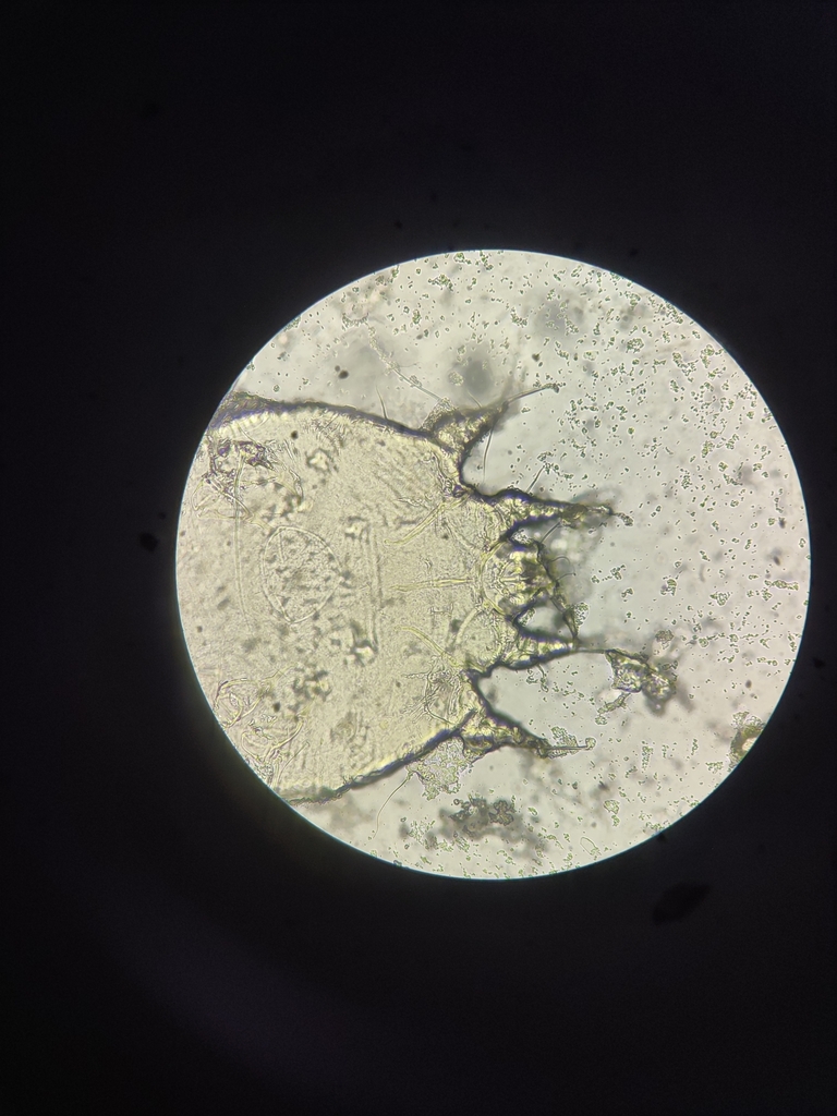Scabies Mite from Surabaya, ID-JI, ID on November 29, 2023 at 03:38 PM ...
