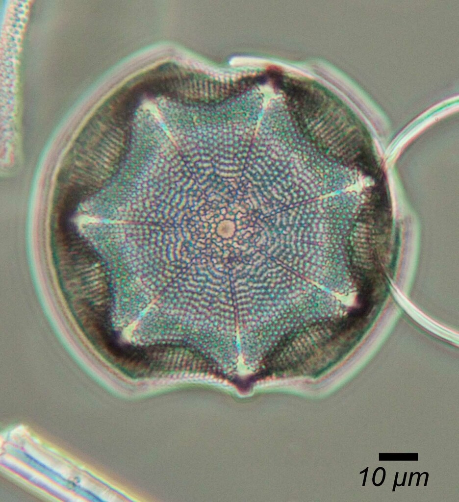 Aulacodiscus kittonii (Surf-Zone Diatoms) · iNaturalist