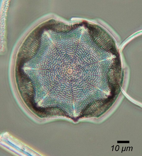 Aulacodiscus kittonii (Surf-Zone Diatoms) · iNaturalist