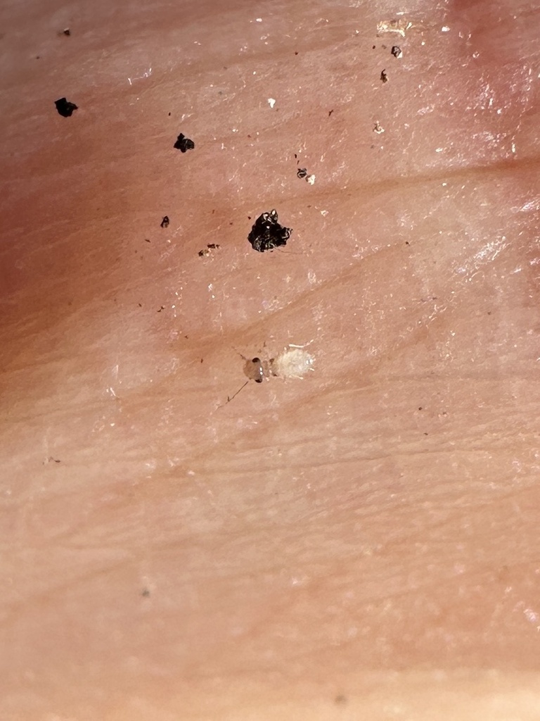 Barklice, Booklice, and Parasitic Lice from Red Rock Canyon National ...