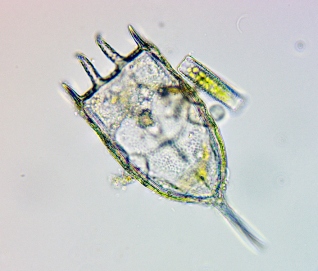 Keratella cochlearis from Skillman, Montgomery, NJ, USA on March 04 ...