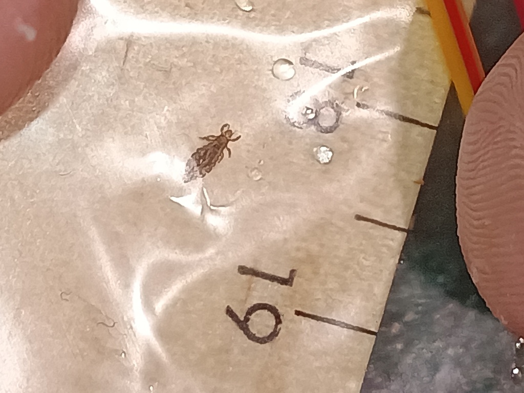 Human Louse from Adelaide SA, Australia on March 10, 2024 at 08:23 PM ...