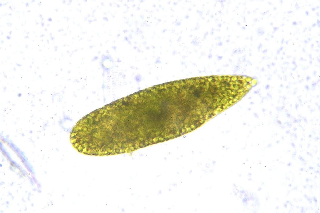 euglenoids from Southeast Calgary, Calgary, AB, Canada on March 18 ...