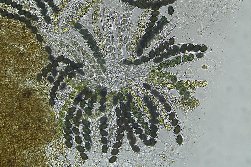 Sordaria macrospora from Port Albert VIC 3971, Australia on March 22 ...