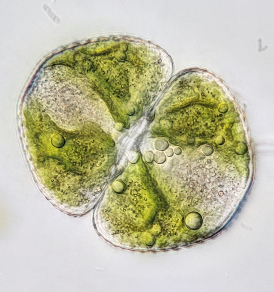 Cosmarium botrytis from Wainfleet Wetland CA, Niagara, ON, Canada on ...