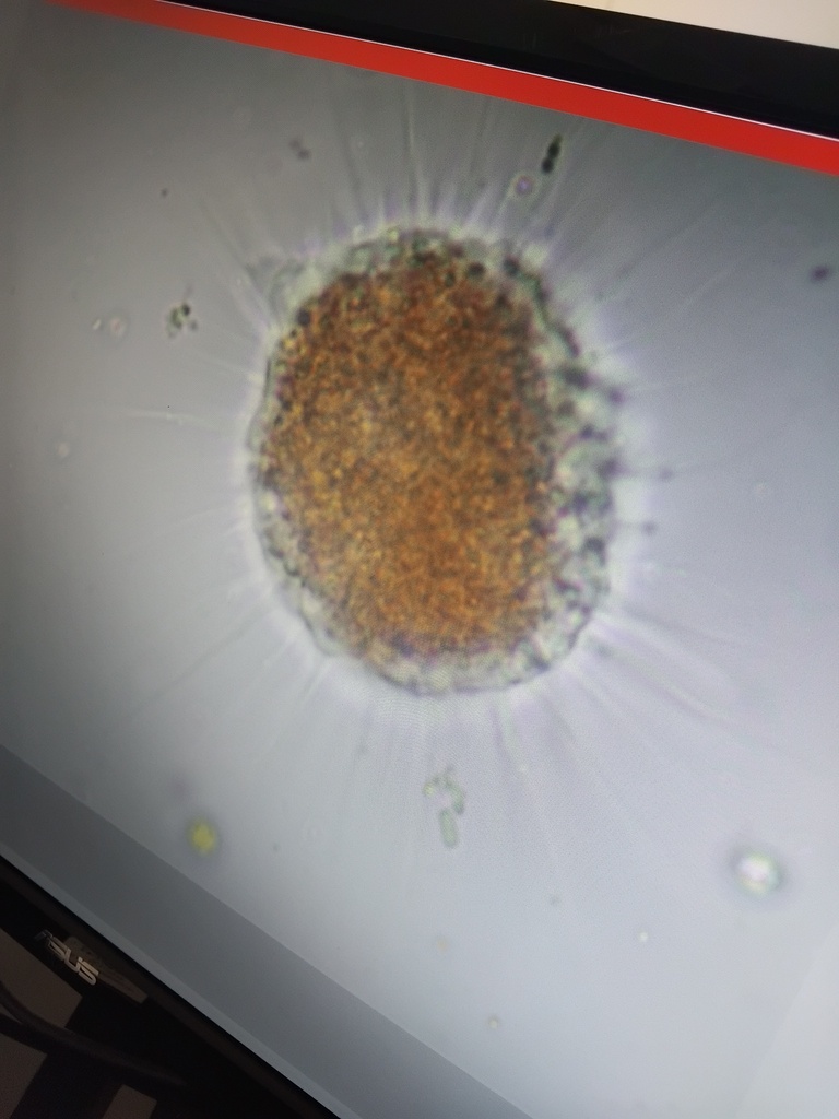 Vampire Amoebae from Sydney NSW, Australia on March 28, 2024 at 11:27 ...