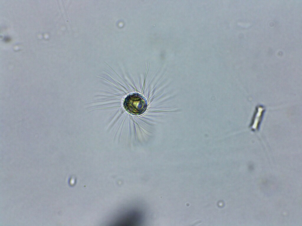 Mallomonas from Breakwater bridge Geelong VIC, Australia on April 26 ...