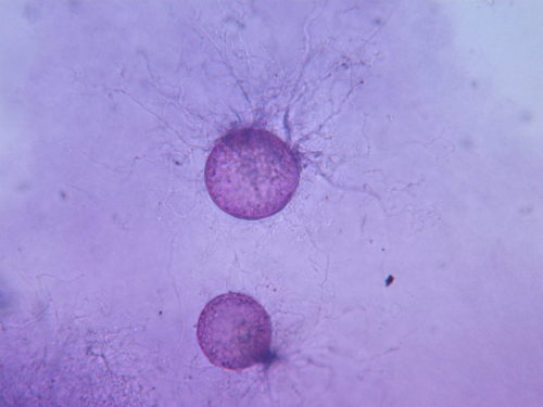 Family Rhizophydiaceae · iNaturalist