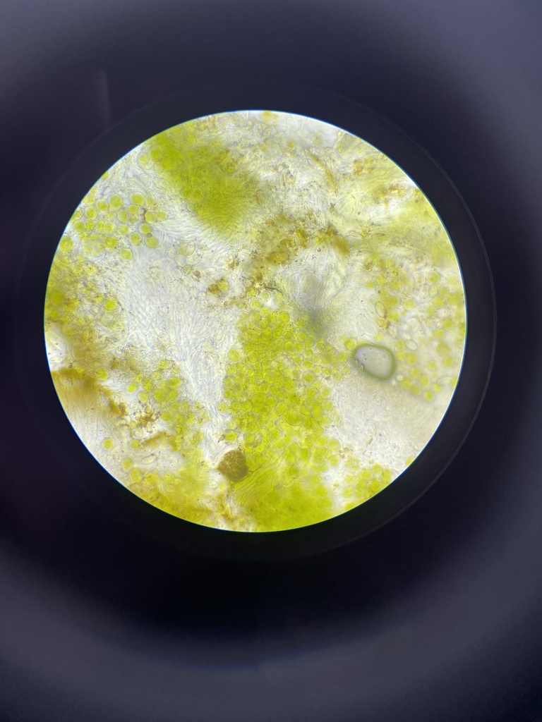 Trebouxia in May 2024 by Efren Chen. Association with Xanthoria ...