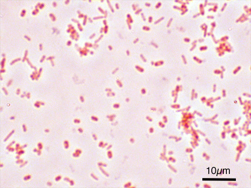 Salmonella Gram Stain