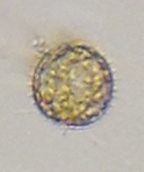 Entamoebidae