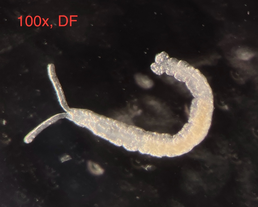 Protodrilidae from Sylt, List auf Sylt, Schleswig-Holstein, DE on May ...