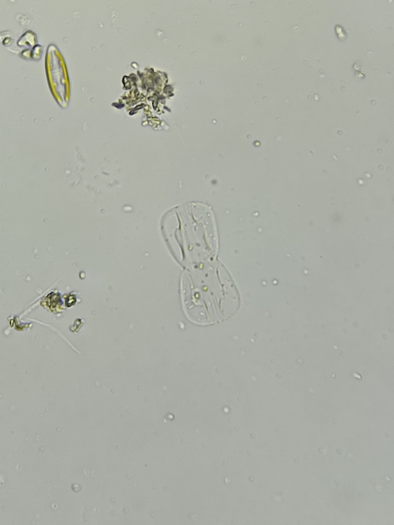 Entomoneis from Barcelona, España on July 25, 2022 at 08:00 PM by jordi ...