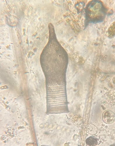 Codonellopsis orthoceras · iNaturalist Ecuador