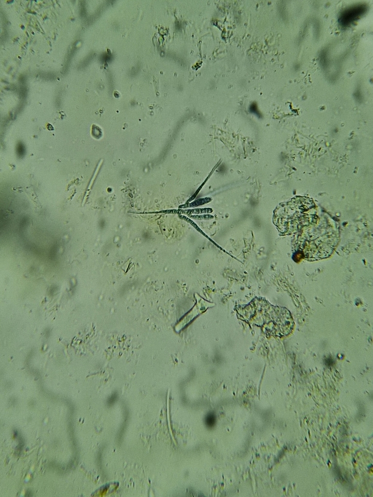 Tetracladium setigerum from Crossbasket House, Glasgow G72 9UE, UK on ...