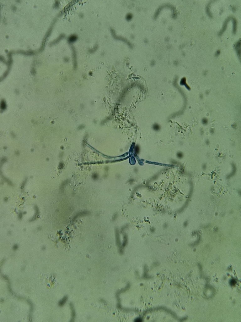 Tetracladium marchalianum from Crossbasket House, Glasgow G72 9UE, UK ...