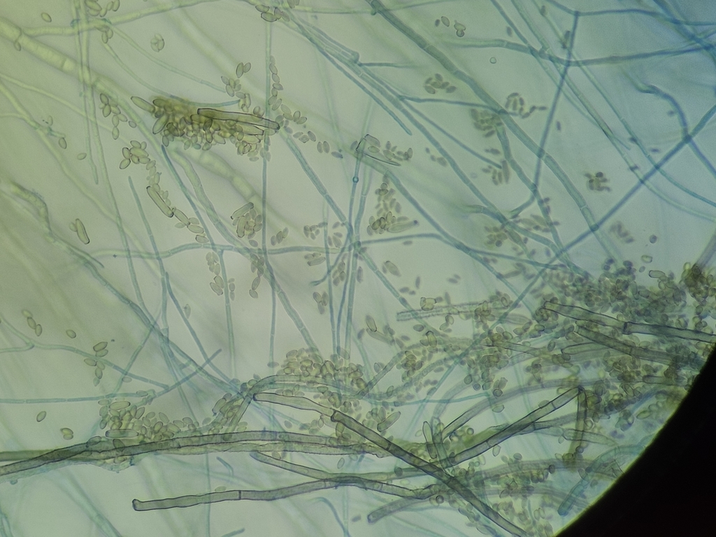 Cladosporium from Monacillo Urbano, San Juan, Puerto Rico on May 28 ...