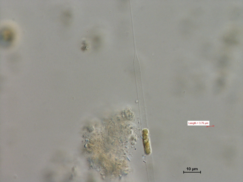 Urosolenia from 36300 Ruffec, France on September 4, 2023 at 10:32 AM ...