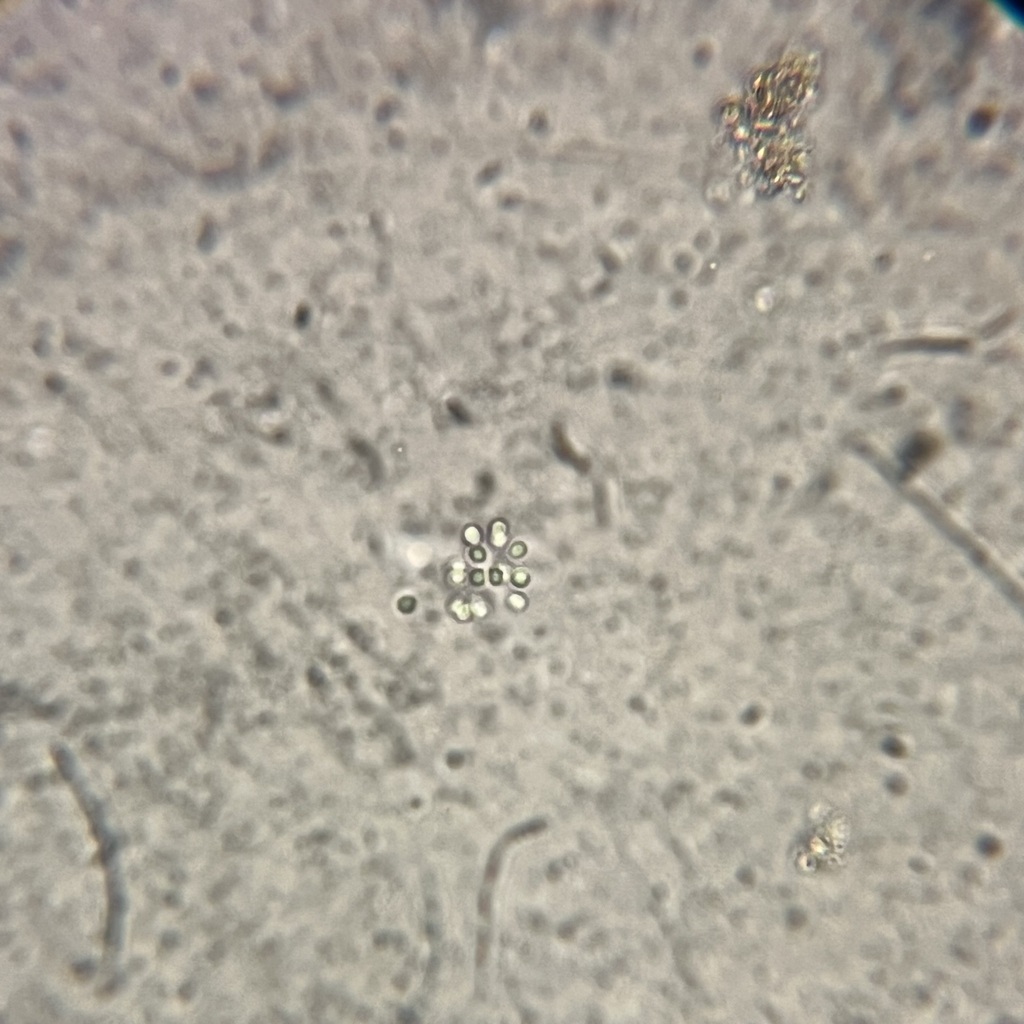 cyanobacteria from Ladue, MO, USA on June 17, 2024 at 01:45 PM by azeff ...