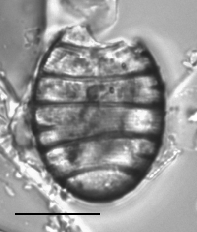 Form Tetracyclus ellipticus minor · iNaturalist