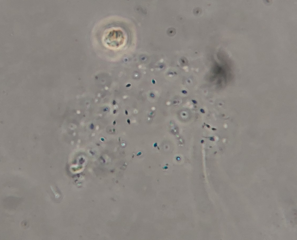 Rhabdogloea smithii in March 2023 by Alex Kenins. From a Lugols then ...