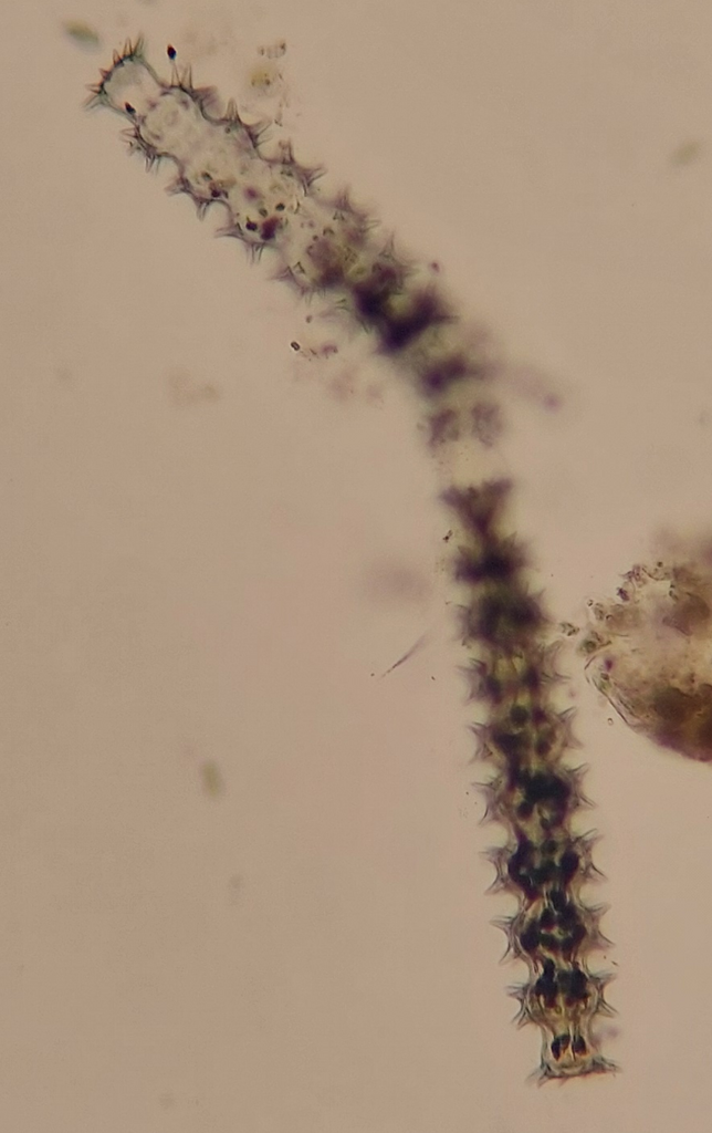 Pleurotaenium kayei in March 2023 by Alex Kenins. From a Lugols then ...