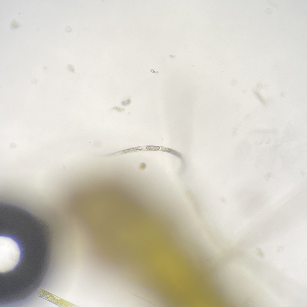Nematodes from Razorback Lake, Sayner, WI, US on July 4, 2024 at 06:30 ...