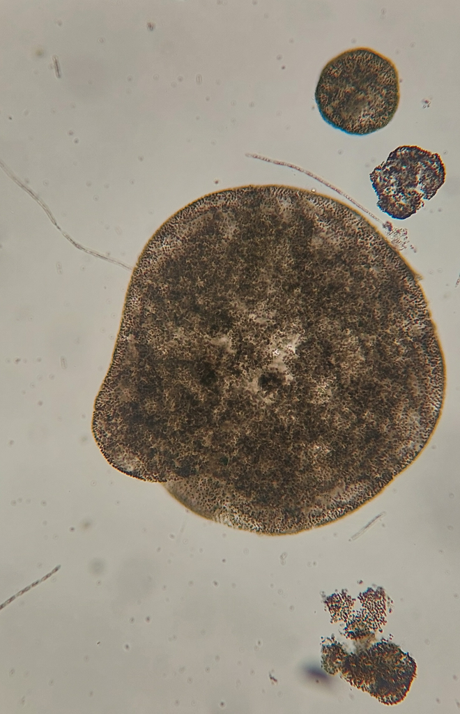 Microcystis flos-aquae from Gold Coast QLD, Australia on July 1, 2024 ...