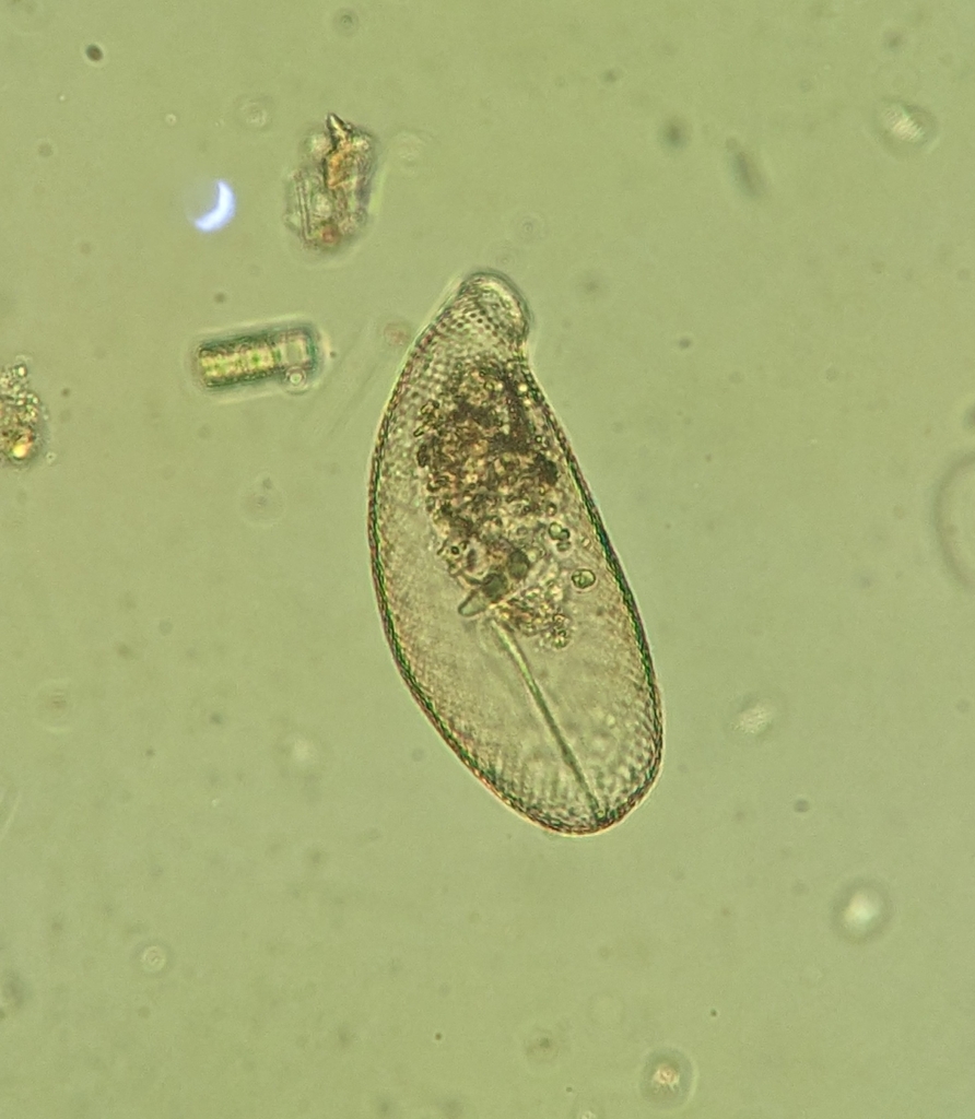 Cyphoderia from Estacada, OR 97023, USA on July 9, 2024 at 10:41 PM by ...