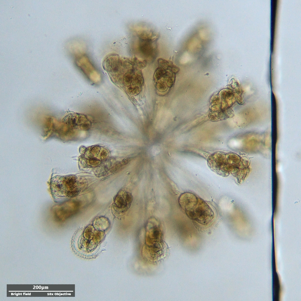 Conochilus hippocrepis from Исток, Каннельярви, Выборгский р-н ...