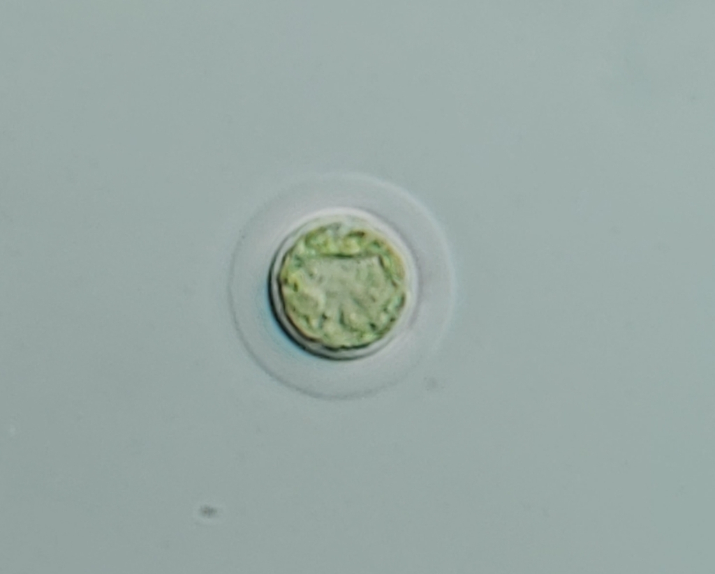 Gloeocystis gigas from Lake Niapenco, Tyneside Trail, Hamilton, ON L0R ...