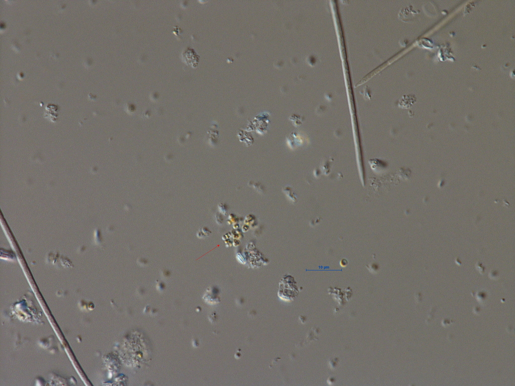 Cyanocatena planctonica from 67260 Harskirchen, France on October 12 ...