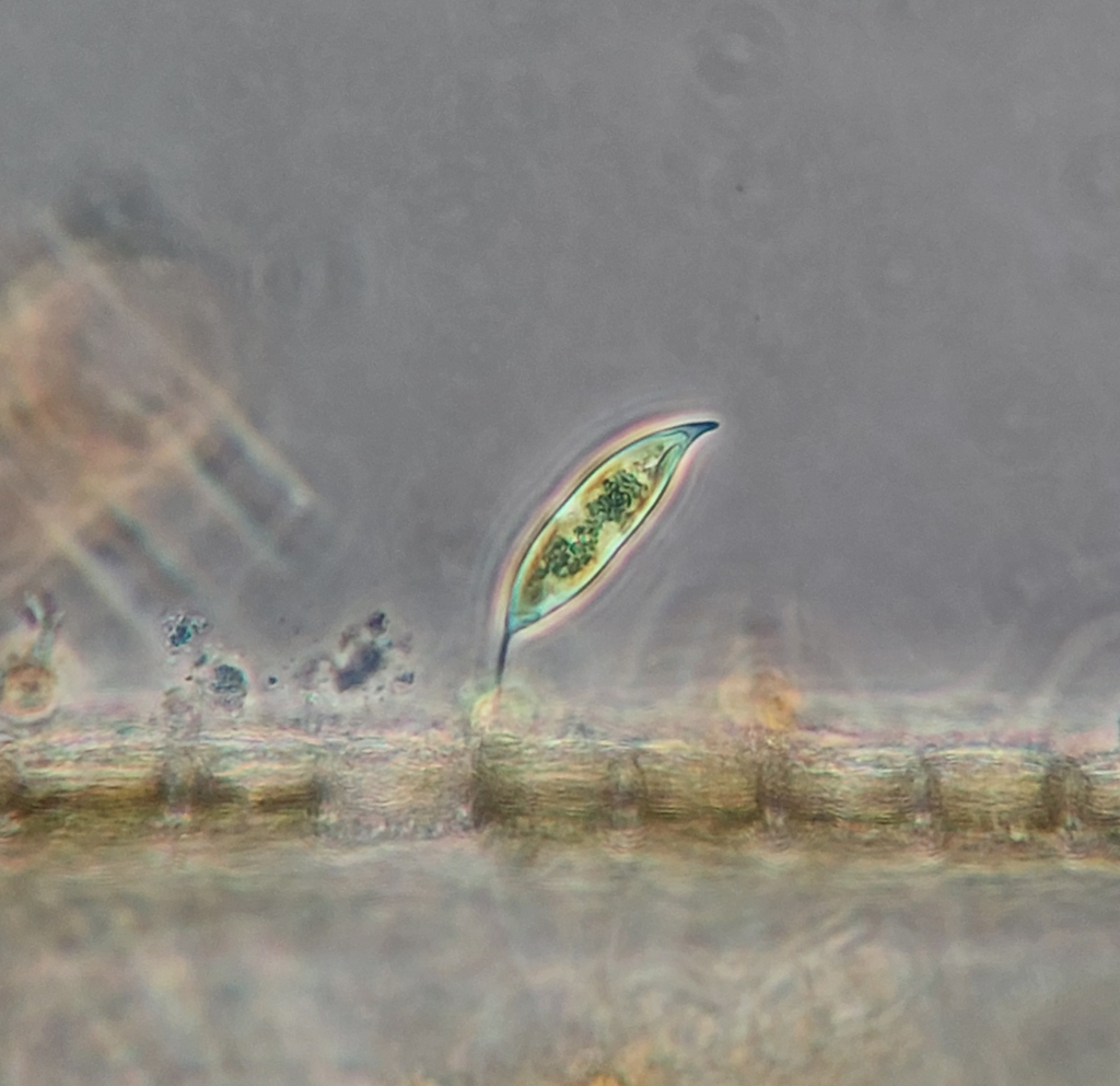 Characium from Brisbane QLD, Australia on July 27, 2024 at 01:24 PM by ...