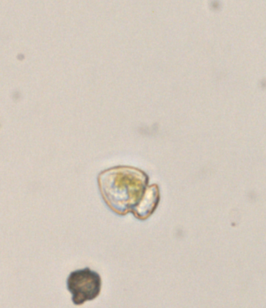 Heterocapsa from San Diego County, CA, USA on July 29, 2024 at 02:28 PM ...