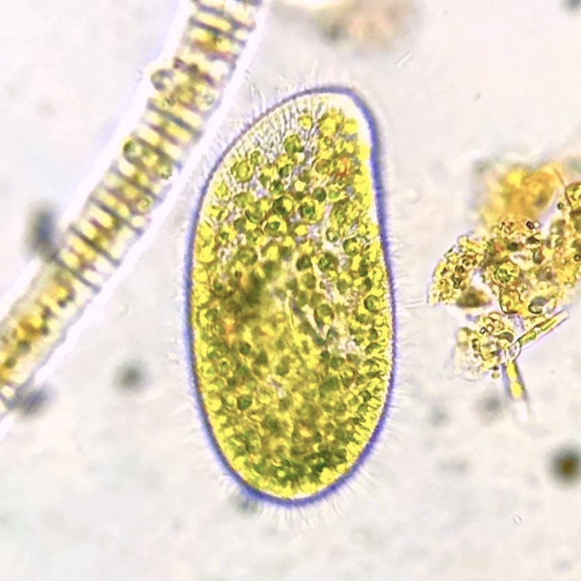 Paramecium Bursari