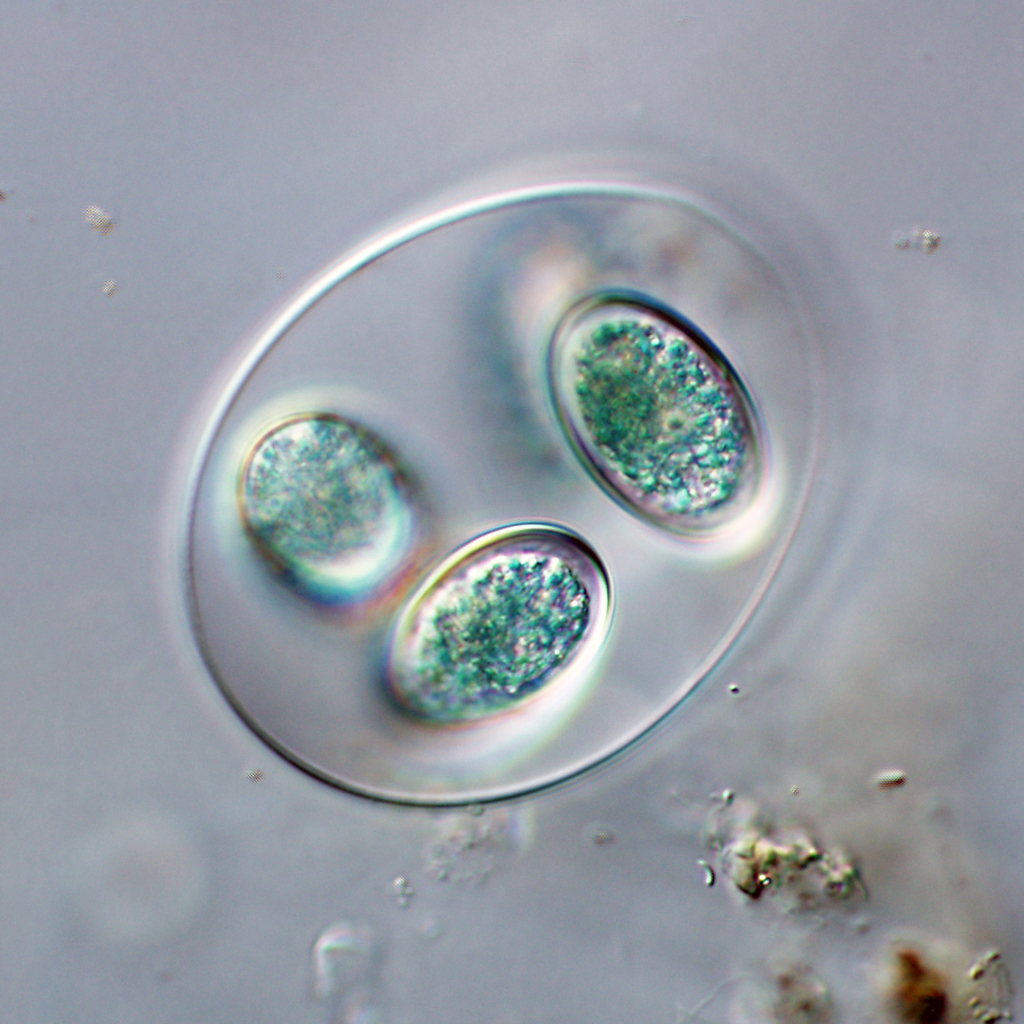 glaucophyte algae (Glaucophyta) - Botanical Realm
