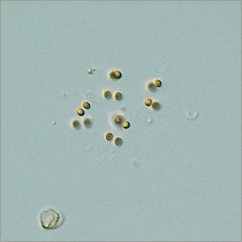 Chroococcus minimus · iNaturalist United Kingdom