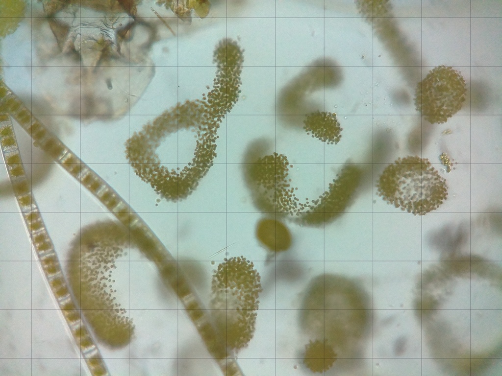 Microcystis aeruginosa from Sunday Lake, Stanwood, WA, US on August 26 ...