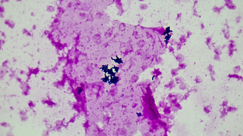 Corynebacterium striatum · iNaturalist