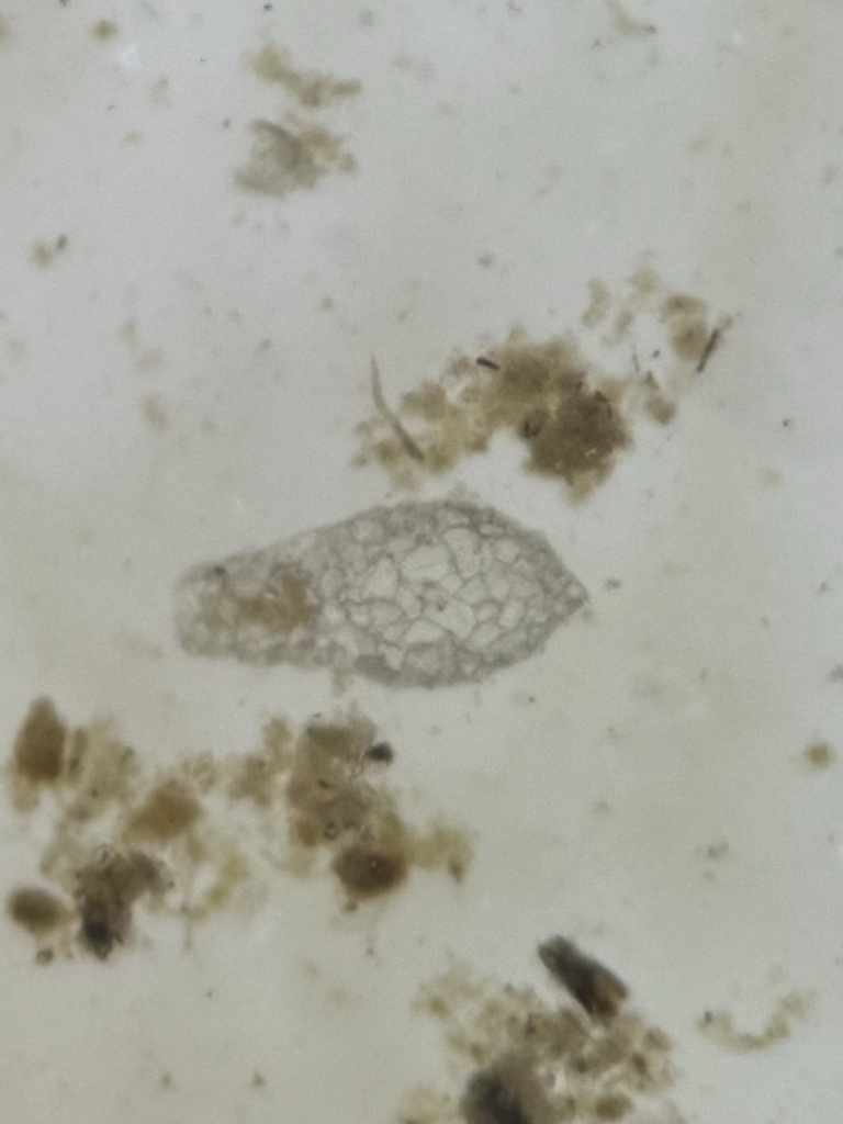 Difflugia venusta from Tuckahoe State Park, Ridgely, MD, US on ...