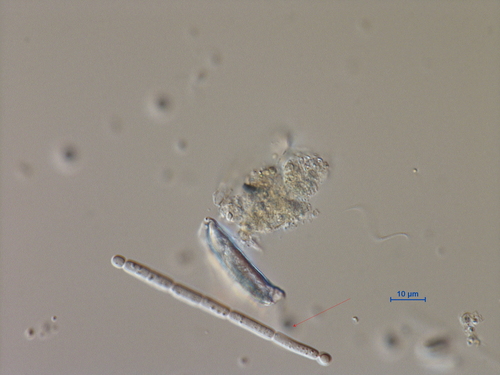 Anabaenopsis cunningtonii · iNaturalist