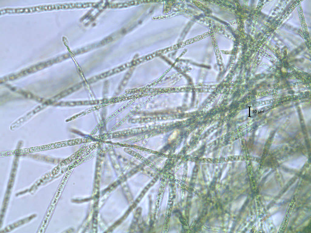 Planktothrix agardhii from East Lake (center) on July 14, 2016 at 04:42 ...