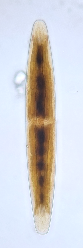 Closterium closteroides intermedium from Talegalla Weir QLD 4650 ...