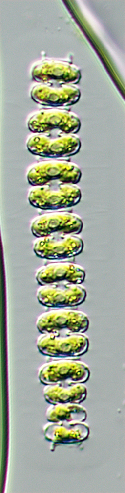 Desmidiaceae from Lake MacDonald QLD 4563, Australia on September 23 ...