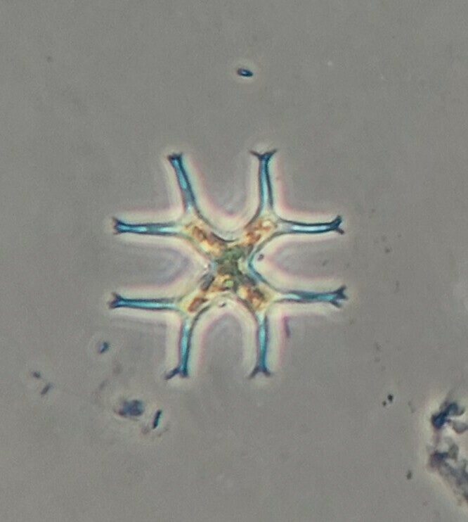 Isthmochloron lobulatum in April 2024 by Alex Kenins. Lugols preserved ...